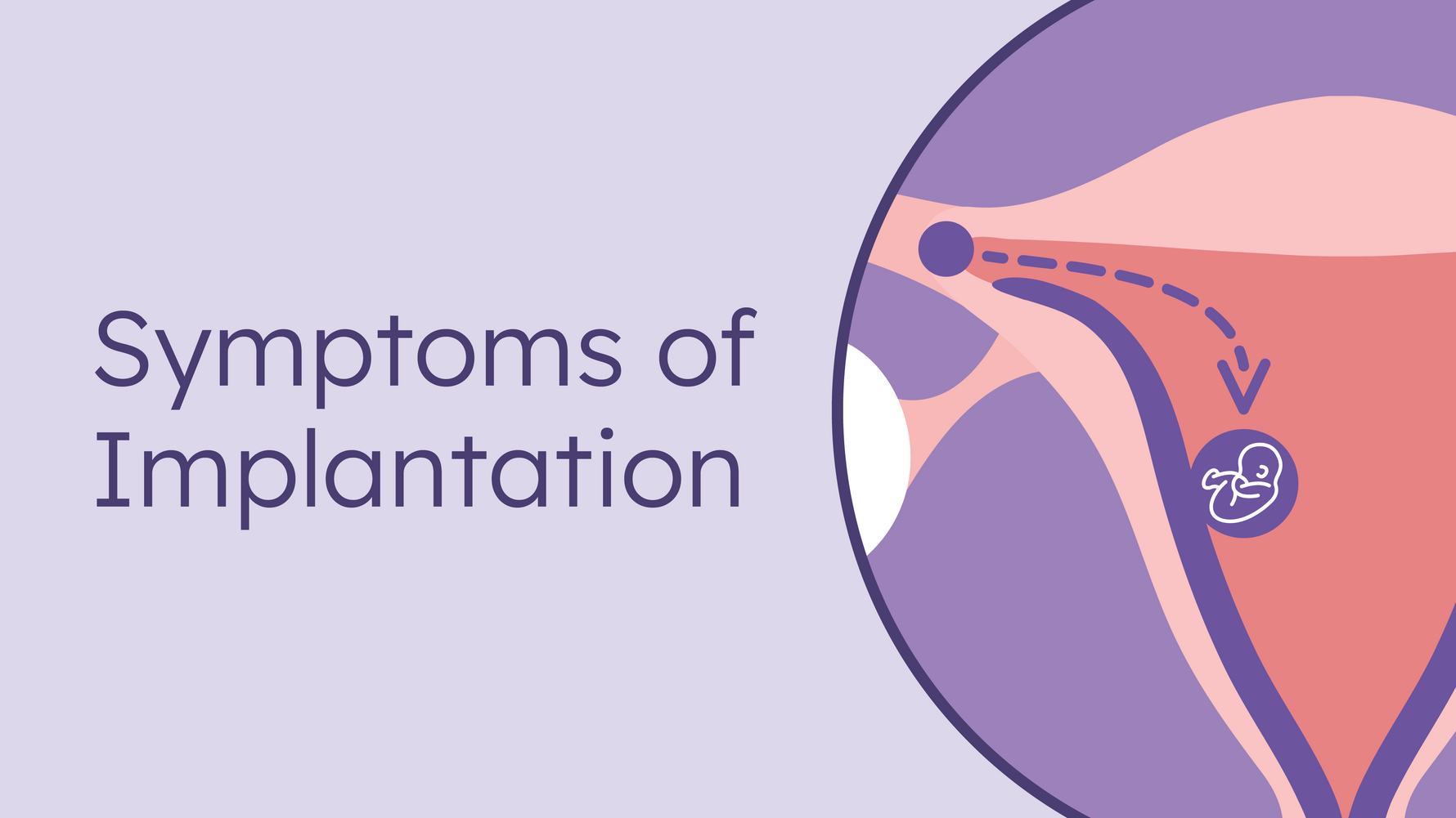 Symptoms of Implantation - The Link Between Progesterone Levels And ...